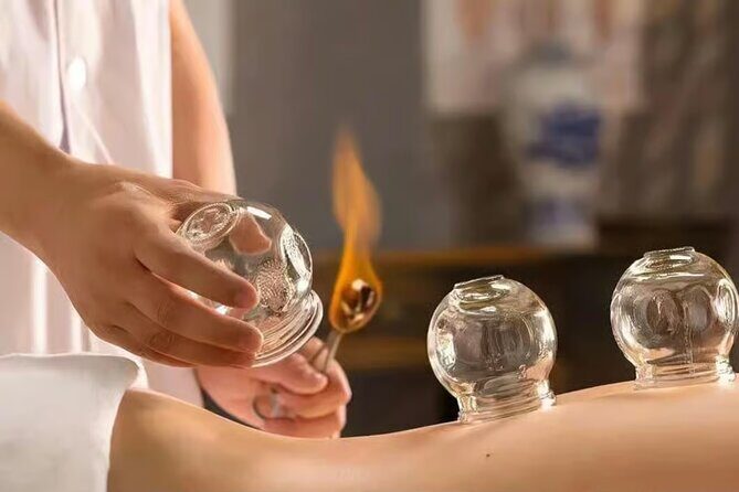 Acupuncture and Suction Cups Session at the Hospital - Key Points