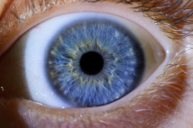 IRIS Photography (macro photo of your eye) - FAQ
