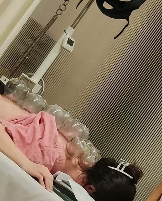 Shanghai: Chinese Medicine Acupuncture and Cupping Session - A Closer Look at the Experience