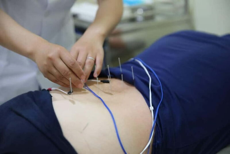 Shenzhen: Acupuncture Experience with TCM Practitioner - Final Thoughts: Who Should Consider This Tour?