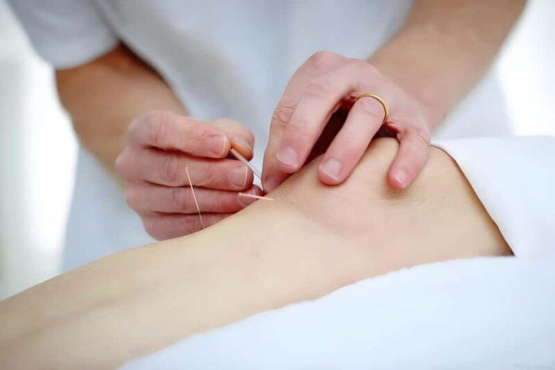 Shenzhen: Acupuncture Experience with TCM Practitioner - FAQ